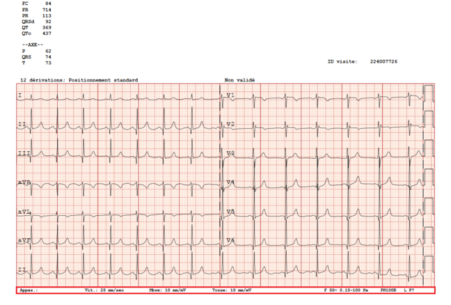 ECG réalisation — Uness Cardiologie